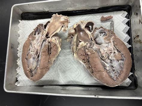Heart Dissection Diagram Quizlet