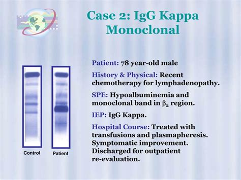 What Is Igg Kappa Igg Kappa Myeloma Understanding Types And Subtypes