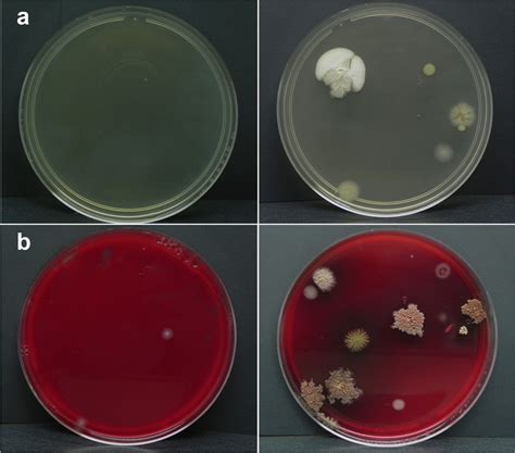 Aedes Aegypti Females Transfer Viable And Cultivable Bacteria To Solid