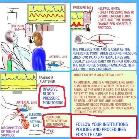 Understanding Hemodynamic Monitoring At Clifford Zak Blog