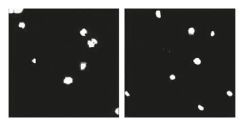 Comparison Of Nucleus Image Segmentation Results A Original Image