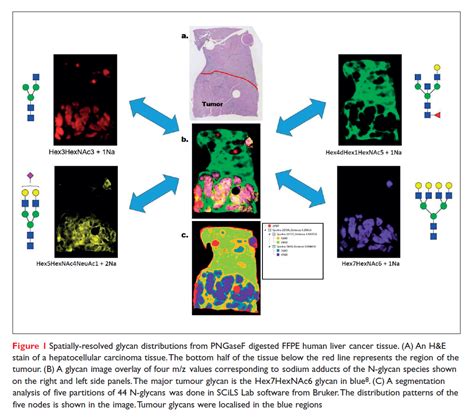 Innovative Glycan Imaging Methods Drive Cancer Biomarker Discovery
