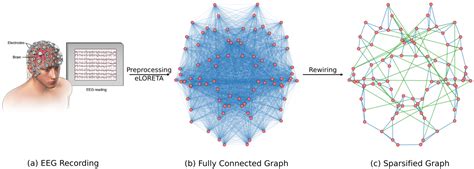 논문 리뷰 Towards Explainable Graph Neural Networks For Neurological