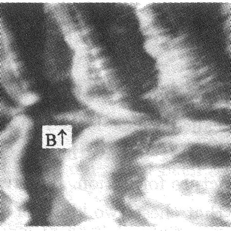 Long Streakb↑ In A Transitional Boundary Layer Ratio 15 X From Download Scientific