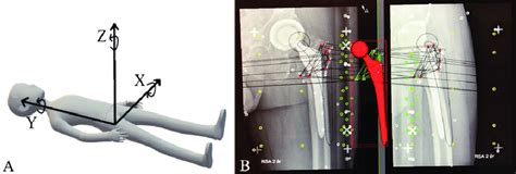 A The Rsa Coordinate System With Movements B Model Based Rsa Download Scientific Diagram
