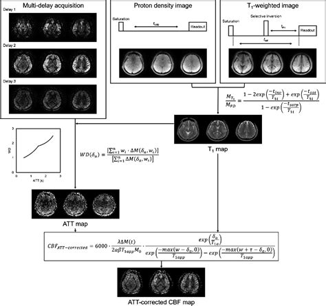 Figure 4 From Perfusion Imaging Using Arterial Spin Labeling Asl Semantic Scholar