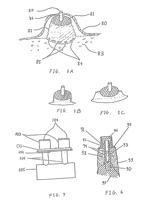 Tissue Expansion Patented Technology Retrieval Search Results Eureka Patsnap
