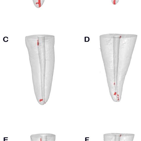 Reconstructed Three Dimensional Micro Computed Tomography Ct Images
