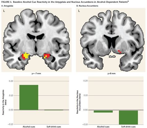 Retrain The Brain Effects On Neural Alcohol Cue Reactivity Recovery Research Institute