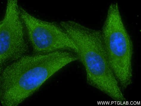 Afp Antibody 82982 5 Rr Proteintech 武汉三鹰生物技术有限公司