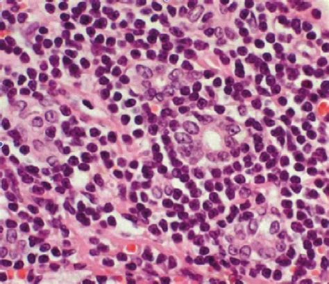 Approaching The Causes Of Cholangitis In Cats Academy En