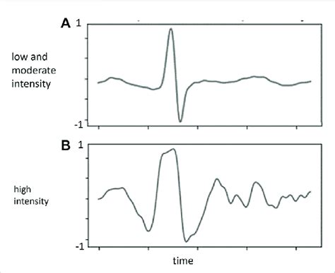 Normalized Weighting Y Axis In Each Ecg Waveform From The Proposed