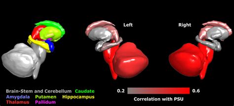 Left Individual Example Of Subcortical Segmentation Colors Represent
