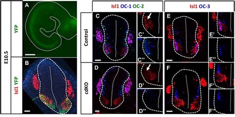 validation of the conditional motor neuron specific oc null mice a
