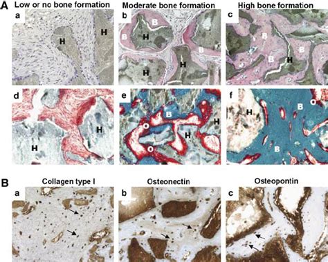 Histological Analysis Of Heterotropic Bone Formation A