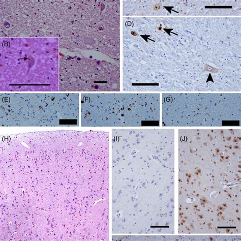 Quantification Of Insoluble Tdp‐43 Peptide Species Within Cns Tissue Download Scientific