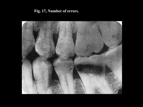 Lecture 7 Dental X Ray Film Processing And Processing Errors Lecture 7