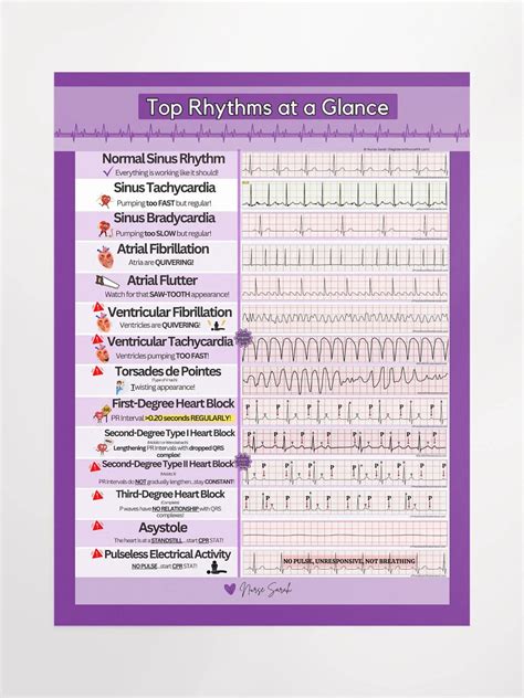 Ecgekg Rhythms At A Glance Wall Poster By Nurse Sarah Nurse Sarah®