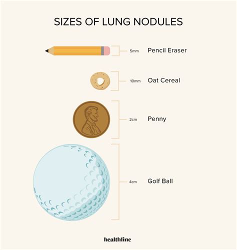 Lung Nodules Symptoms Causes Diagnosis And Treatment