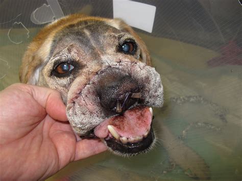 Maxillectomy Radical — Dr Julius M Liptak