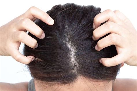 What Causes Dry Scalp 5 Major Reasons Explained