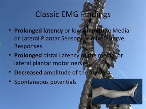 Emg Test For Cervical Radiculopathy Erojr