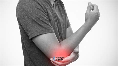 Bursitis De Codo ¿cómo Se Cura Fisioterapia Sierra
