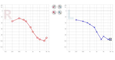 How To Use The Compression Hearing Aid Self Fitting And Adjusting [diy] Hearing Aid Forum