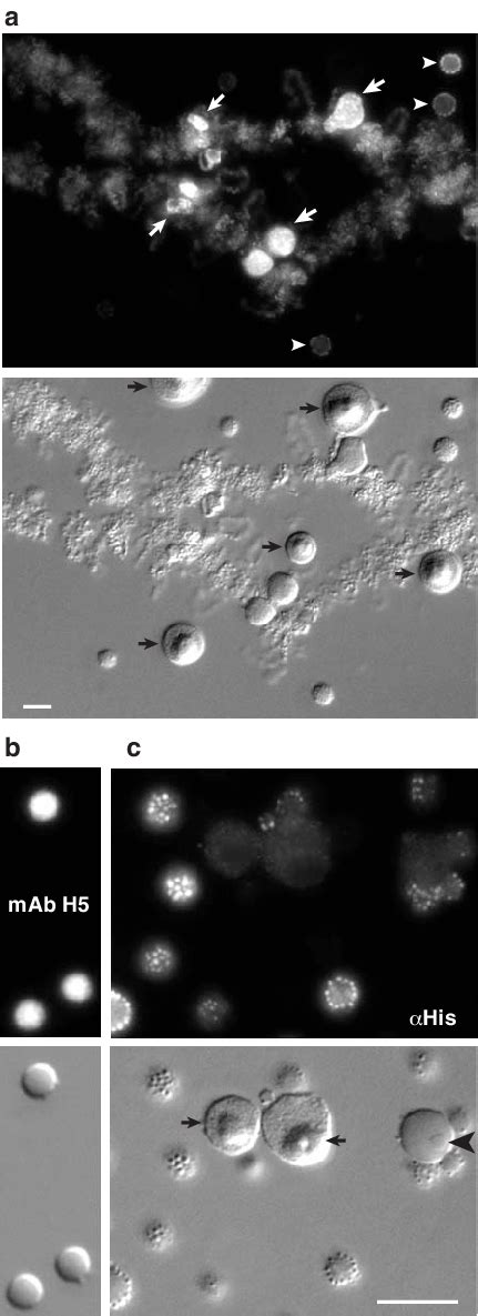 Subnuclear Targeting Of Rbm6 In Xenopus Oocytes A Distribution Of Download Scientific Diagram