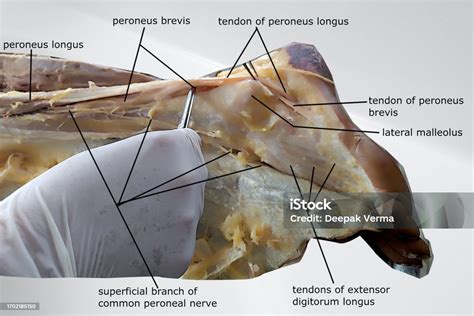 근육과 힘줄은 다리와 발의 수준에서 비골 그룹의 힘줄 0명에 대한 스톡 사진 및 기타 이미지 0명 긴비골근 다리 신체