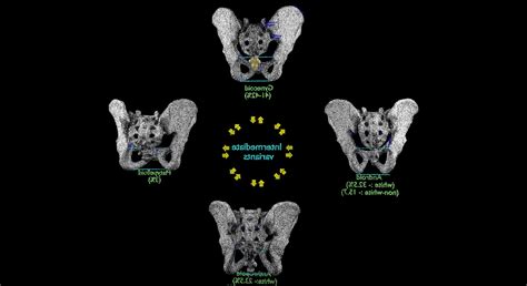 Pelvis Types Hip Bone Labelled Detailed 3d Model Superhive Formerly Blender Market