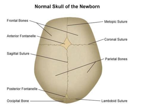 Craniofacial Isfe 2 Craniosynostoses Flashcards Quizlet