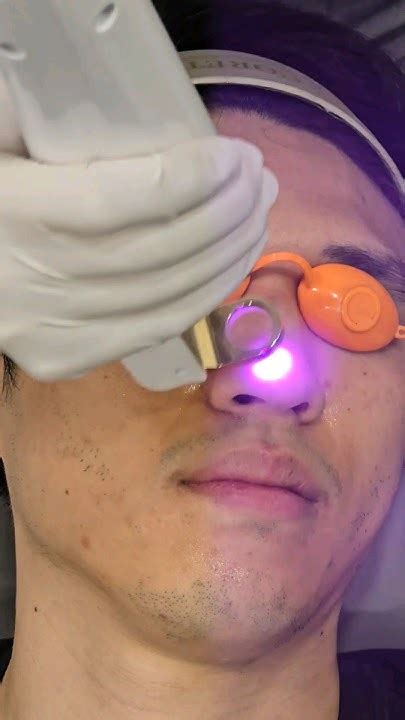 여름철 잡티제거기미 주근깨 미백 여름 피부관리 Youtube