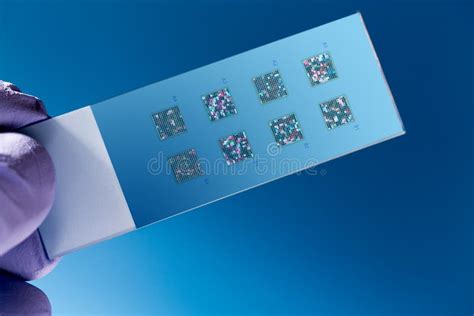 Biochip Stock Image Image Of Medical Futuristic Hand 44548627