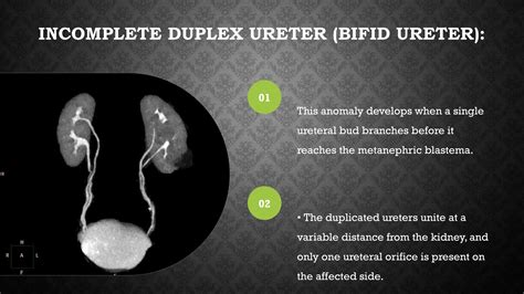 Duplex Renal Systemcompletepartial Duplex Renal System Pptx