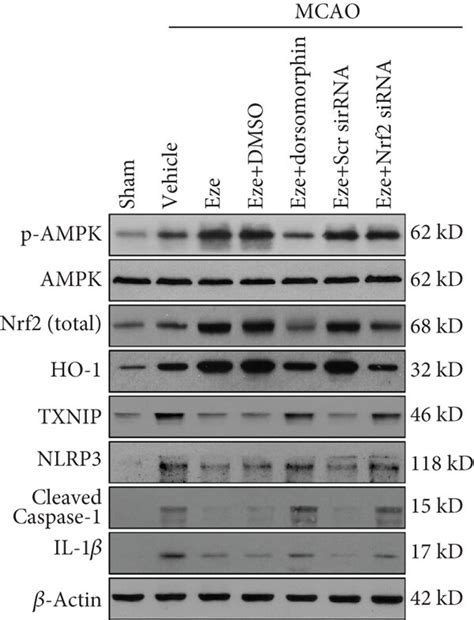 Eze Attenuated Oxidative Stress And Neuroinflammation Via The Download Scientific Diagram