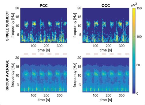 Fig S10 Short Time Fourier Transformation Stft Of Eeg Data For
