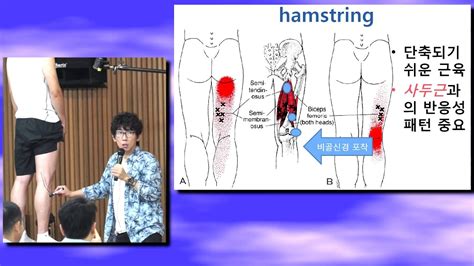 2 3 미세전류 침을 이용한 신경자극치료 무료 강의 최수용 원장 Youtube