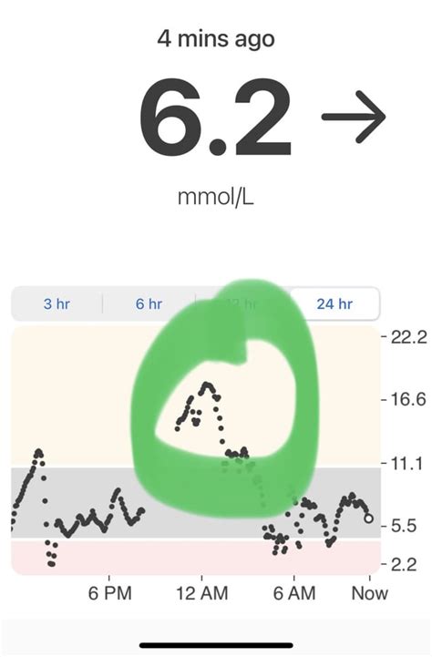 Dexcom Falls Off Then Pod Fails And This Guy Has The Audacity To Smile At Me R Diabetes T1