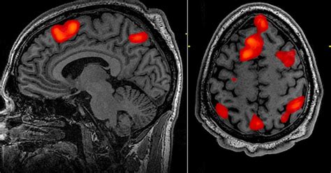 What Is Fmri Uses How It Works Duration And What To Expect