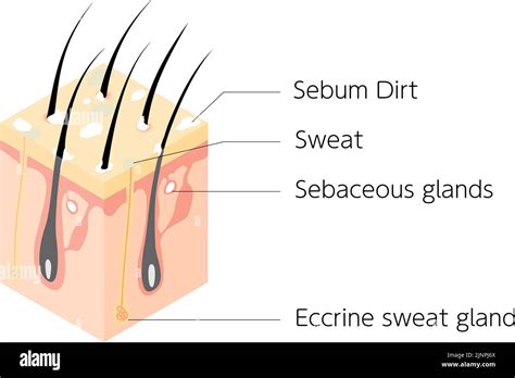 Diagrammatic Illustration Of A Cross Section Of A Dirty Scalp