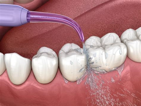 Alternative Options For Flossing Dental Tape Interproximal Brushes