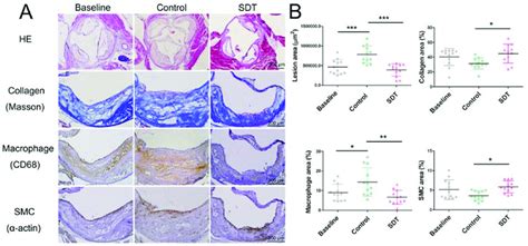 Sinoporphyrin Sodium Mediated Sonodynamic Therapy Dvdms Sdt Modifies