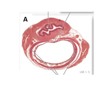 Microscopic Structure Of The Trachea Quiz