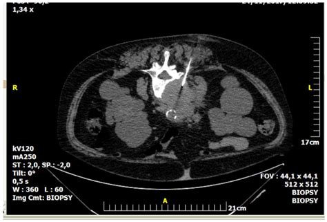 Diagnostic Imaging Guided Biopsy At Angelica Mullins Blog