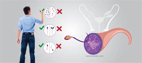 Abnormal Semen Parameter Cause And Treatment