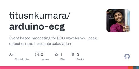 Github Titusnkumaraarduino Ecg Event Based Processing For Ecg