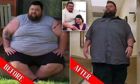 This Morbidly Obese Man Became Addicted To Sleep After Undergoing