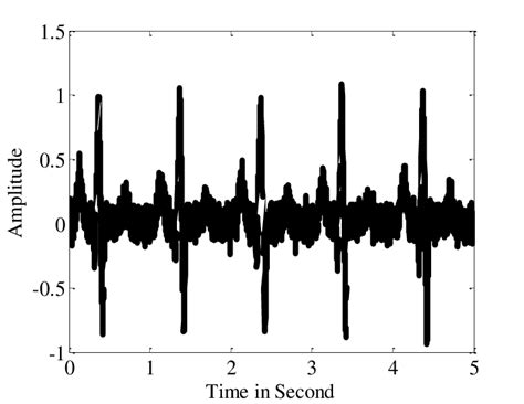 Corrupted Ecg Signal Due To Additive White Gaussian Noise Download Scientific Diagram