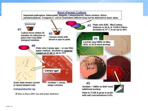 Specimen Processingppt